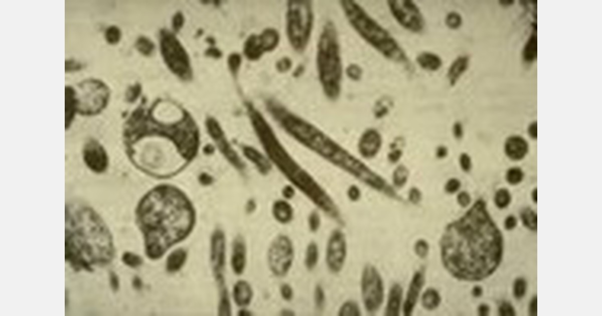 Batteri killer delle piante, pubblicata la nuova lista Ue